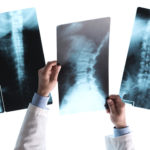 Quantum Radiology | The Leader in Low Dose Imaging